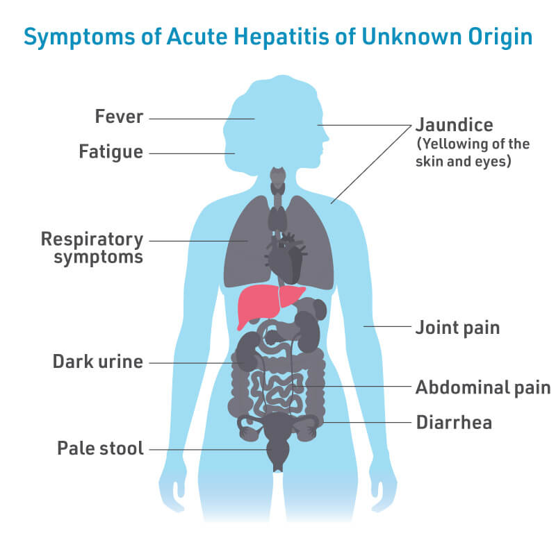 Update on Child Hepatitis