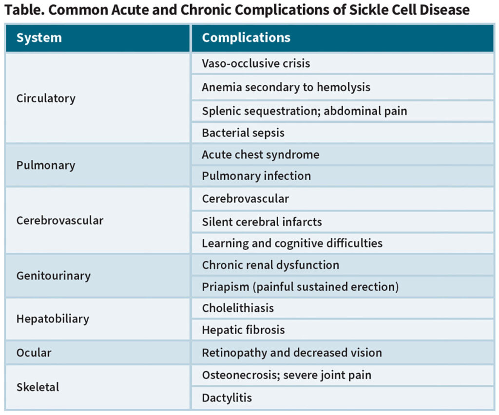 New Gene Therapies Are Transformative for People with Sickle Cell ...
