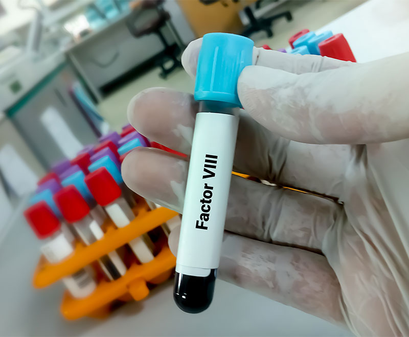 Recombinant and Plasma-Based Factor VIII Products Confer Similar Risks ...
